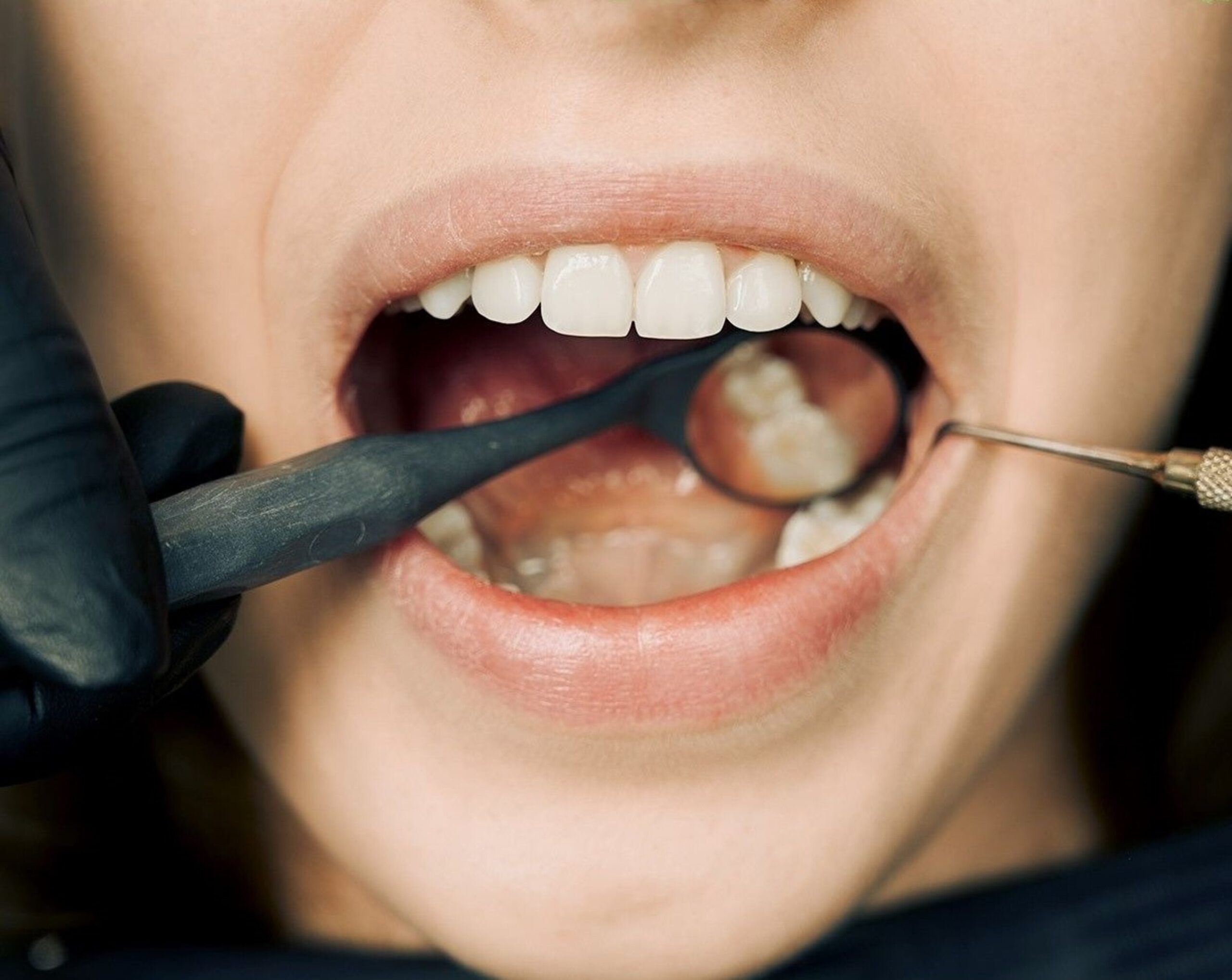 Consequences of Poor Oral Hygiene: 10 Common Dental Problems